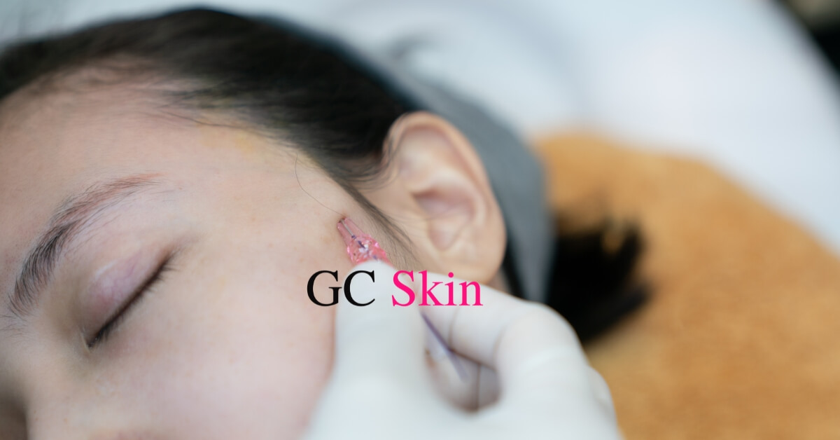 The Versatile Benefits of PDO Threads: Enhancing Aesthetics through ...